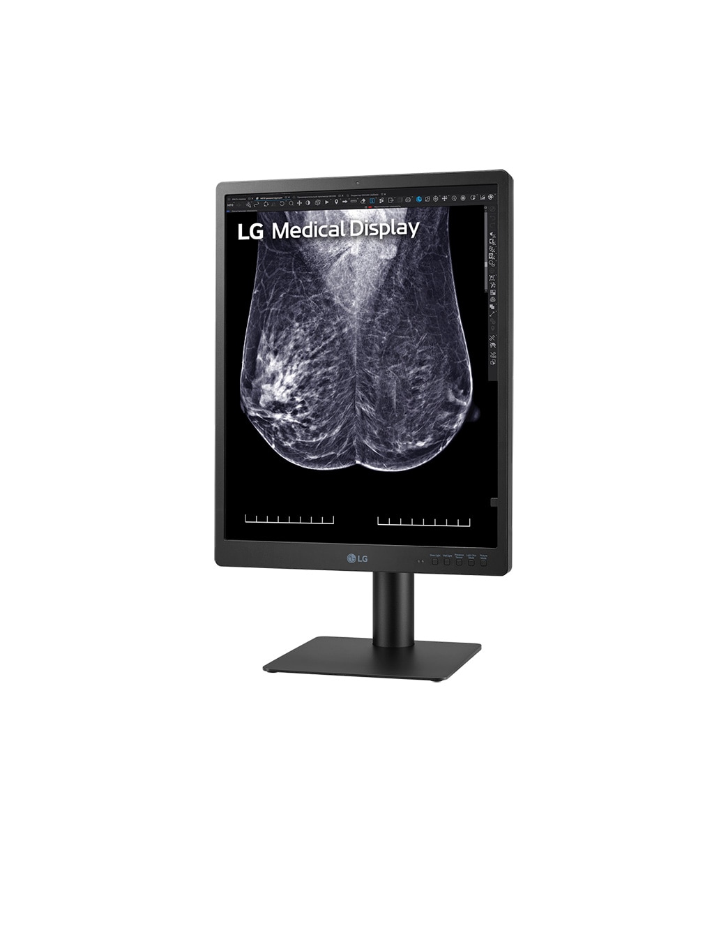 LG 21.3-inch 5MP IPS Diagnostic Monitor for Mammography - 21HQ613D-B ...
