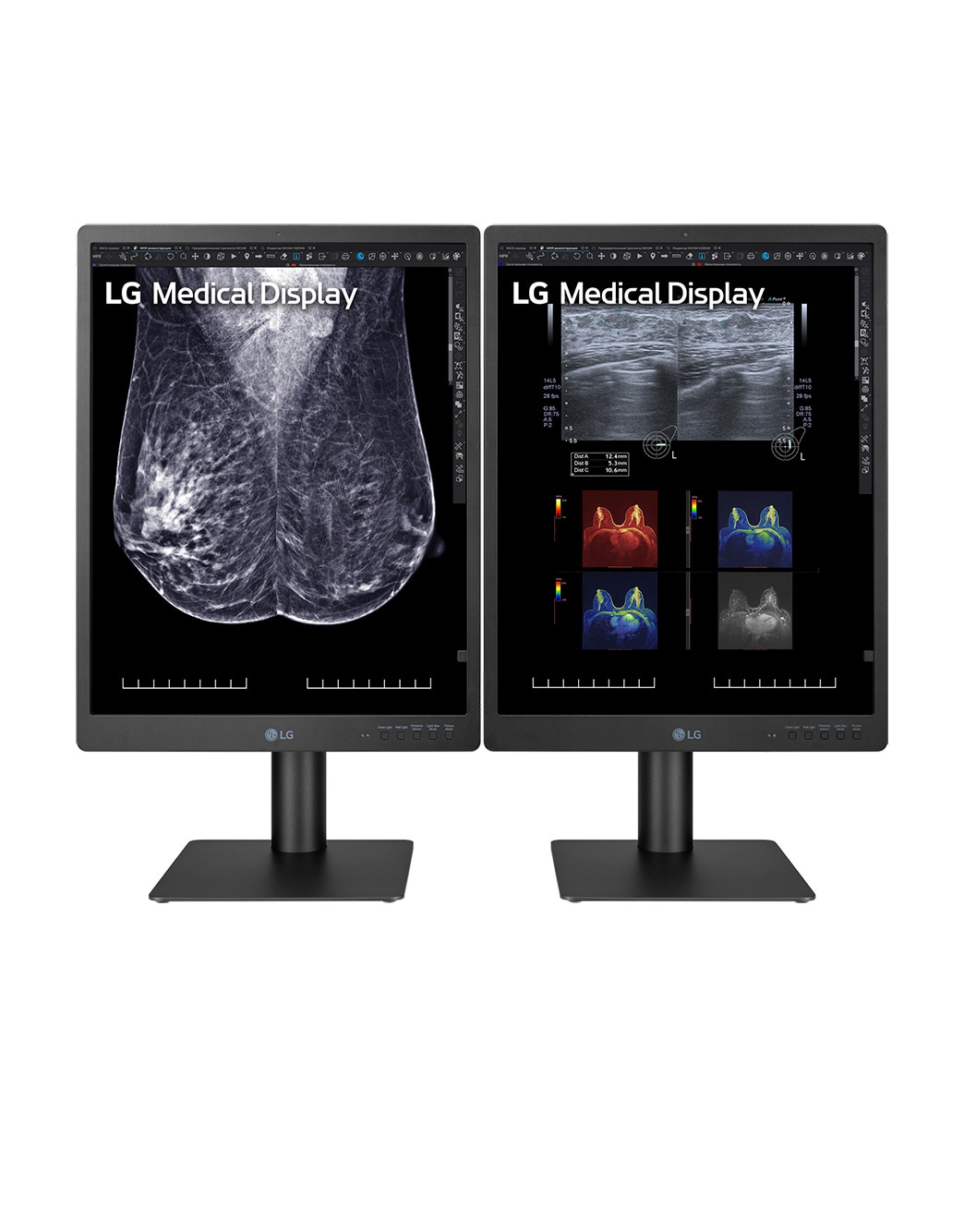 LG 21.3-inch 5MP IPS Diagnostic Monitor for Mammography - 21HQ613D-B ...