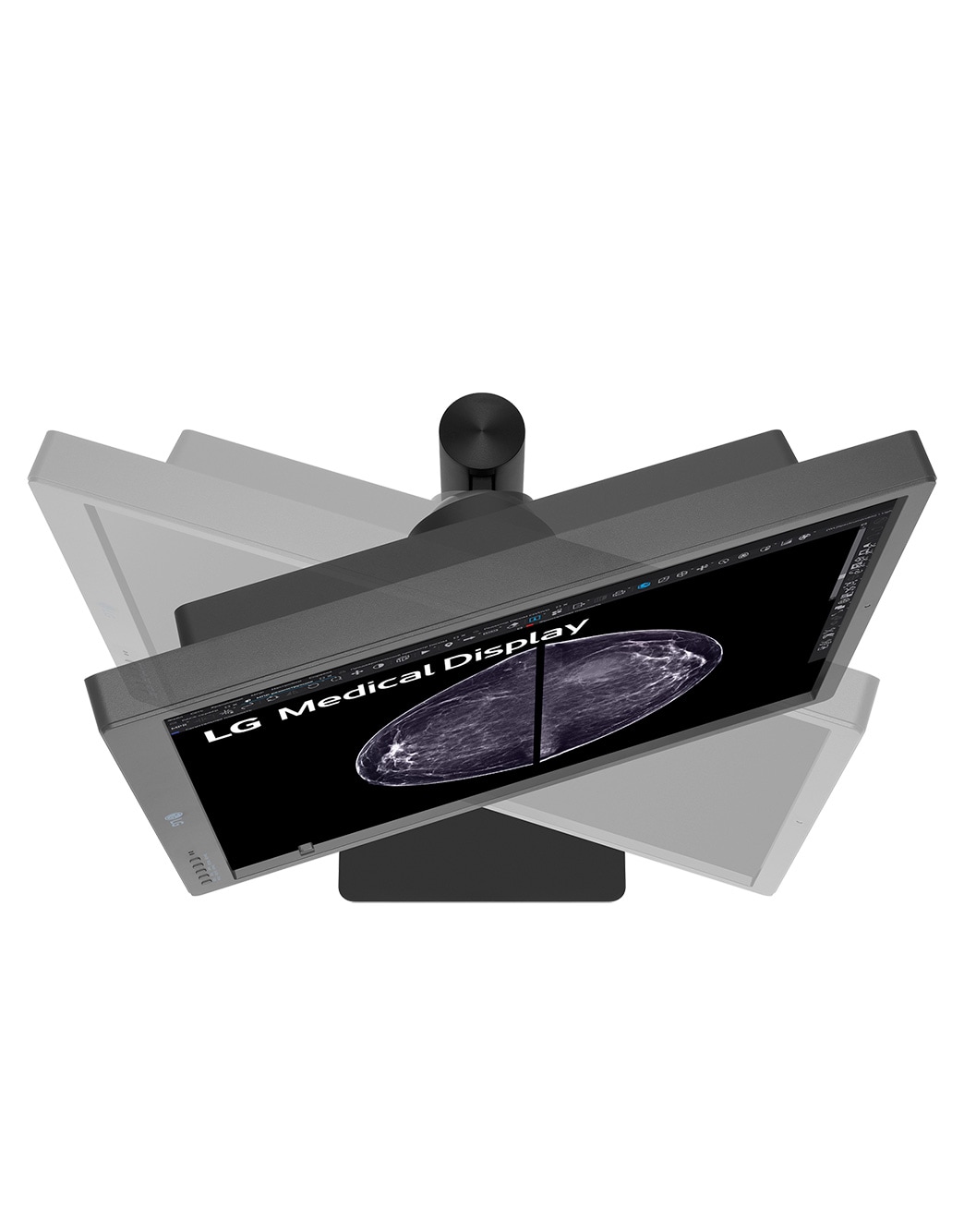 LG 21.3-inch 5MP IPS Diagnostic Monitor for Mammography - 21HQ613D-B ...