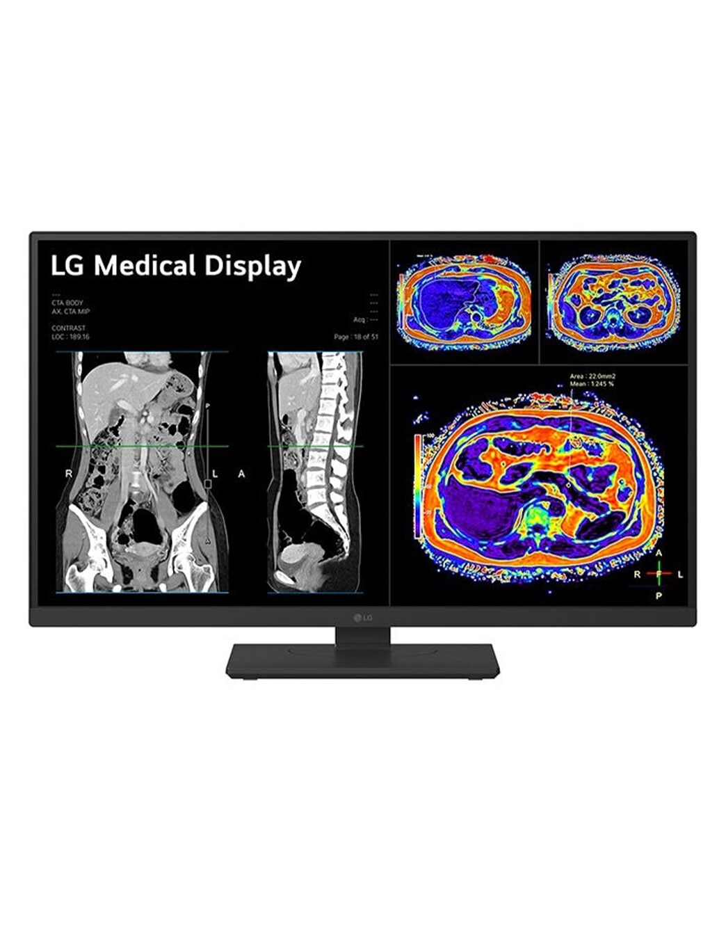LG 27” 8MP IPS Clinical Review Monitor | LG Australia