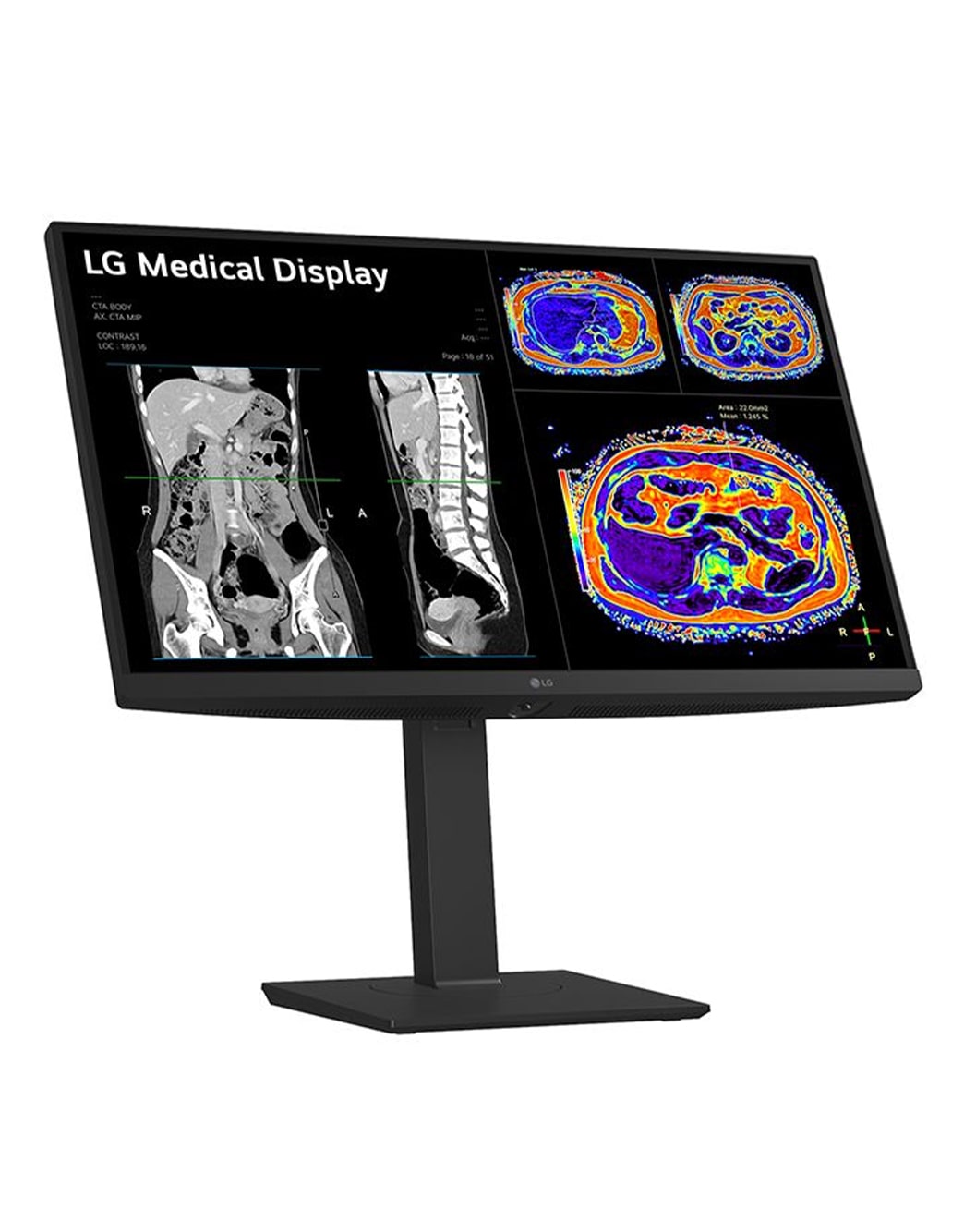 LG 27” 8MP IPS Clinical Review Monitor | LG AU