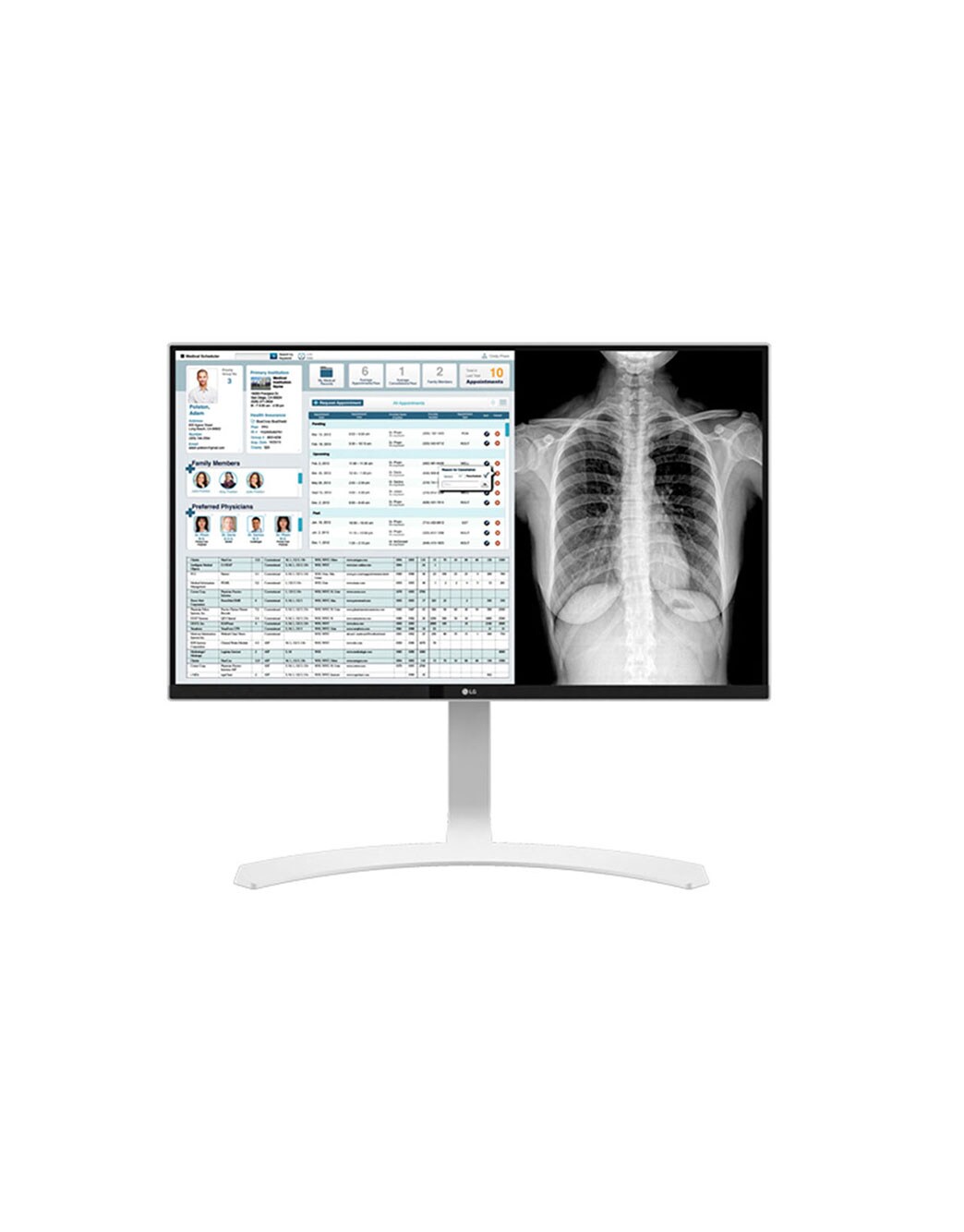 27” Monitor Médico LG 8MP (4K) Branco - 27HJ712C | LG BR