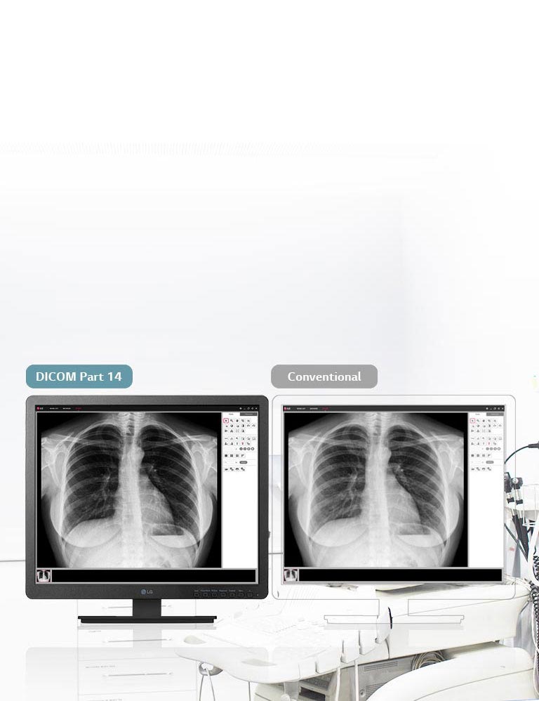 1.3MP Clinical Review Monitor, 19HK312C - 19HK312C-B | LG CA_EN