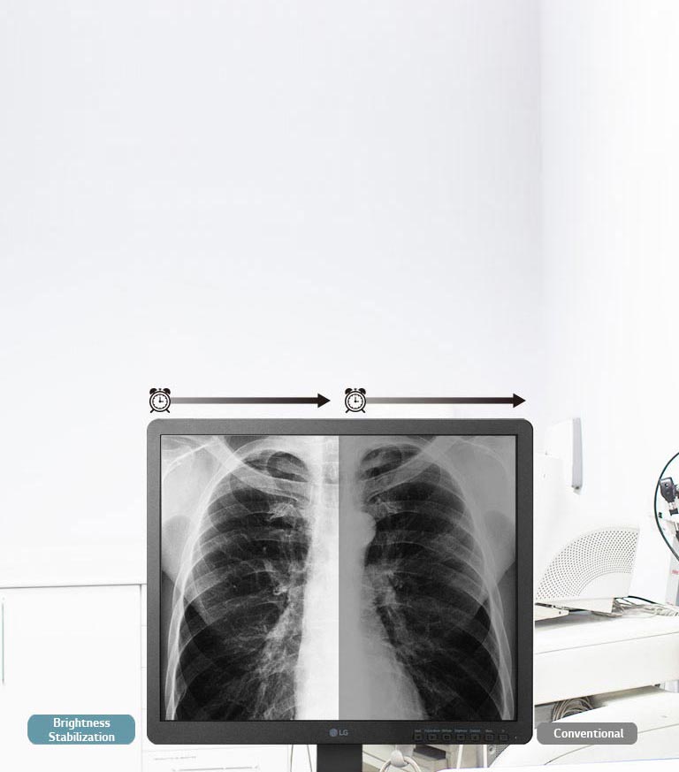 1.3MP Clinical Review Monitor, 19HK312C - 19HK312C-B | LG CA_EN