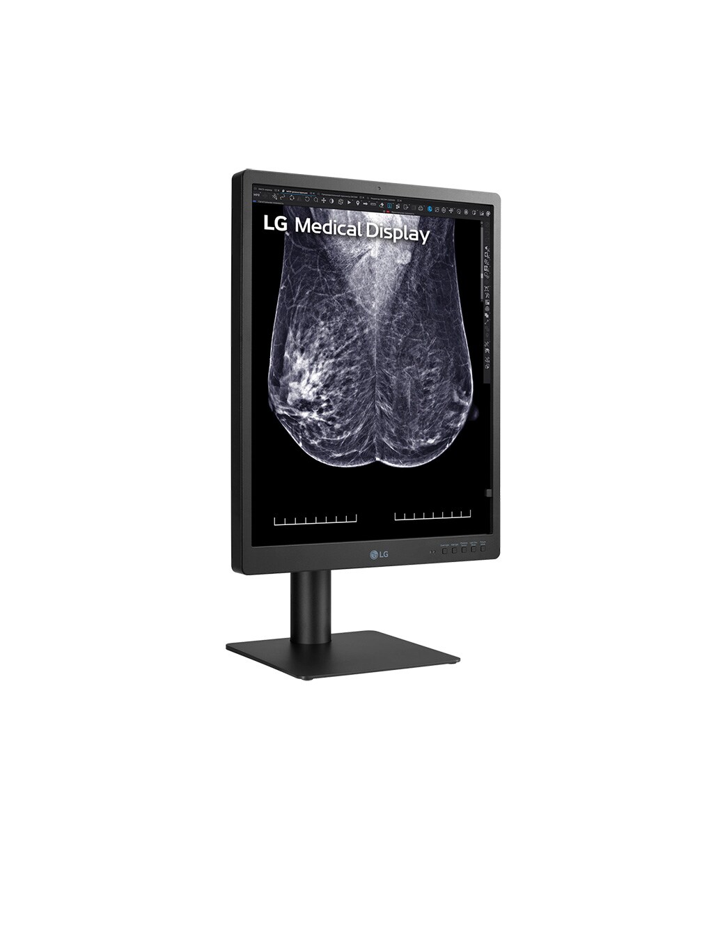 LG 21.3-inch 5MP IPS Diagnostic Monitor for Mammography | LG CA_EN