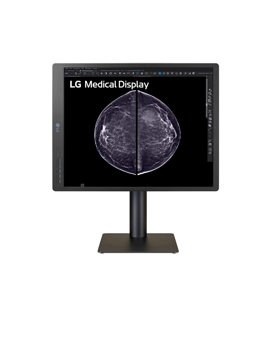 LG 21.3-inch 5MP IPS Diagnostic Monitor for Mammography | LG CA