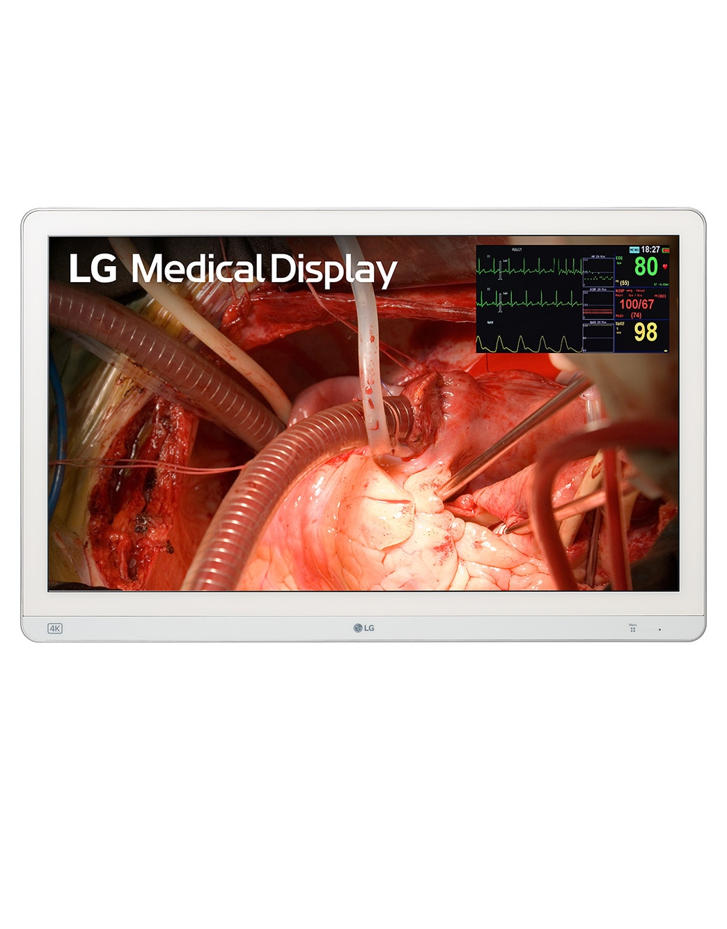 Monitor de Quirófano 27", 4K Mini-LED, 3G-SDI, HDR10, 178º Ángulo de ...