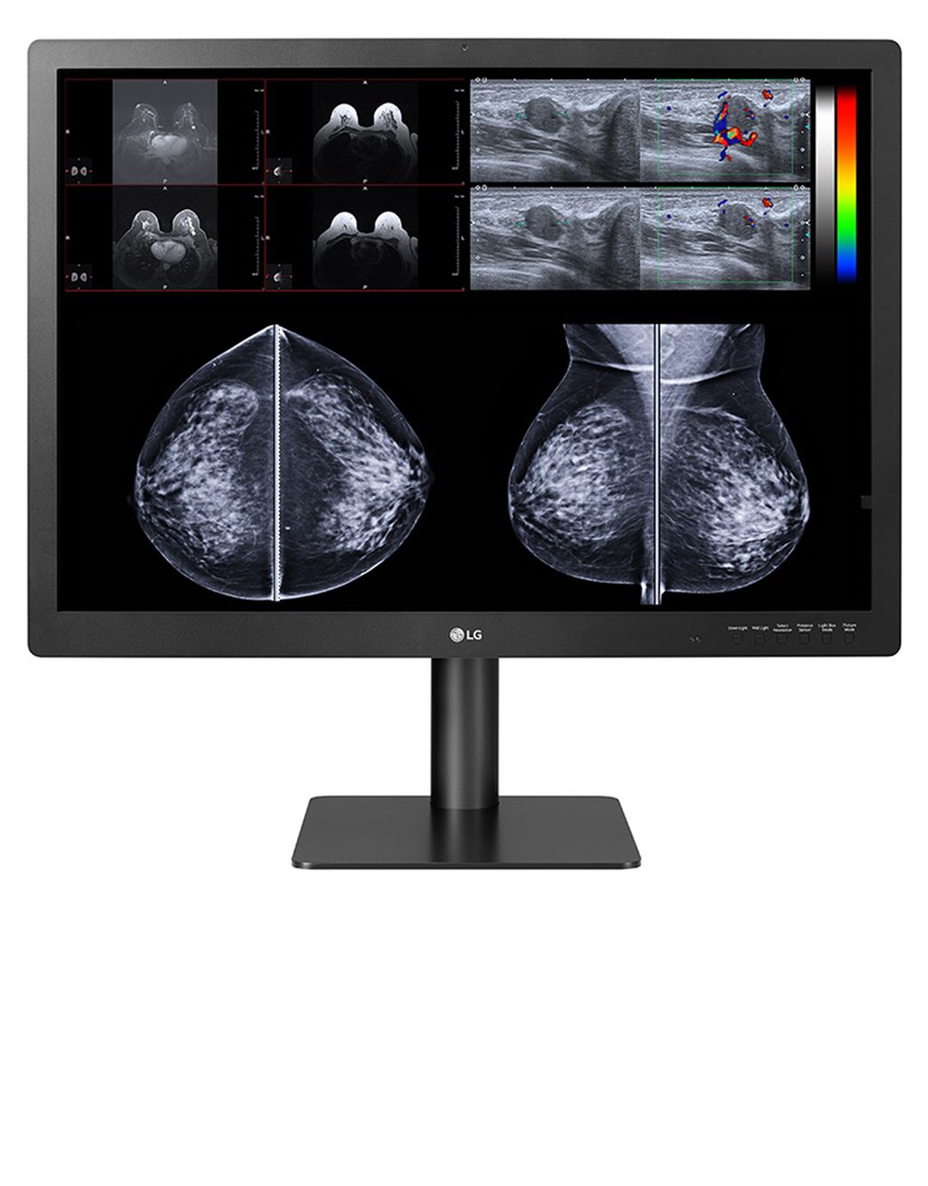 31-inch 12MP IPS Diagnostic Monitor for Mammography - 31HN713D-B | LG HK