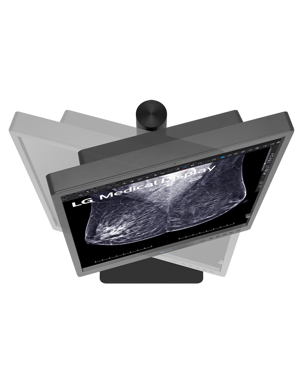 LG 21.3-inch 5MP IPS Diagnostic Monitor for Mammography - 21HQ613D-B ...