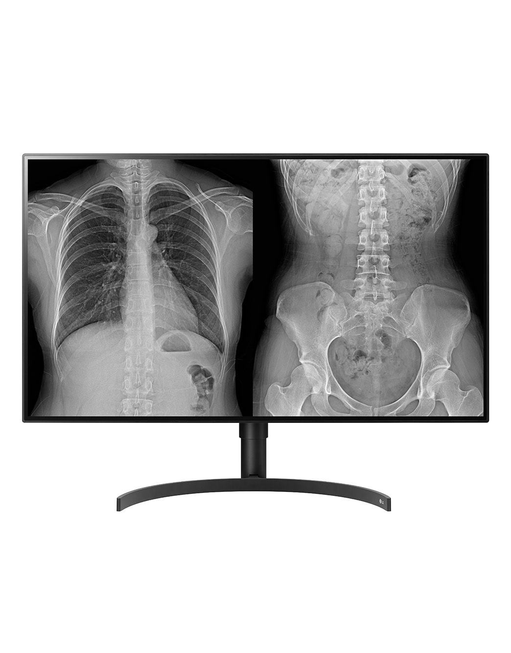 31.5" 8MP Diagnostic Monitor - 32HL512D-B | LG HK_EN
