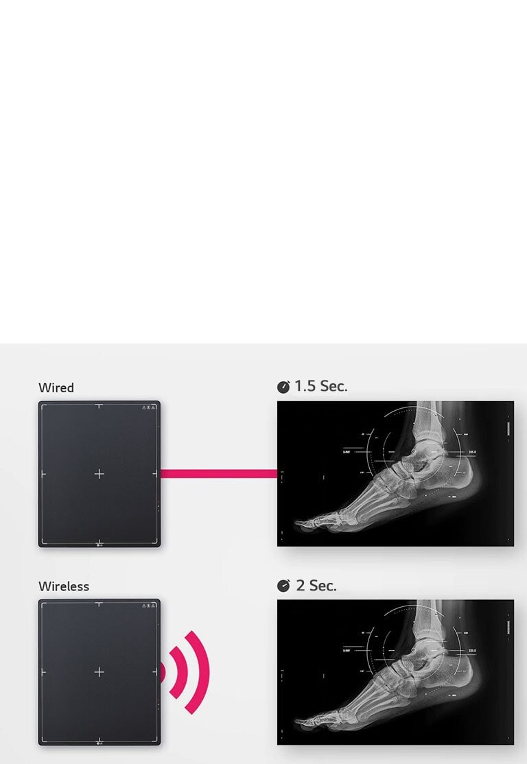 LG Digital X-Ray Detector (DXD) - 14HQ901 | LG IN