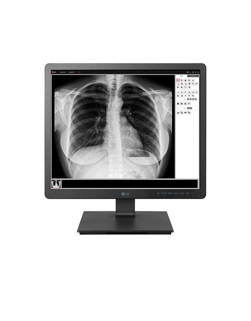 Buy 19 1.3 MP Clinical Review Monitor - 19HK312C-B | LG IN