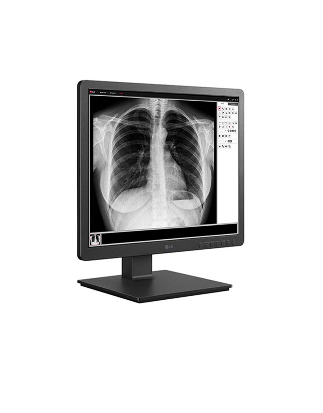 Buy 19 1.3 MP Clinical Review Monitor - 19HK312C-B | LG IN