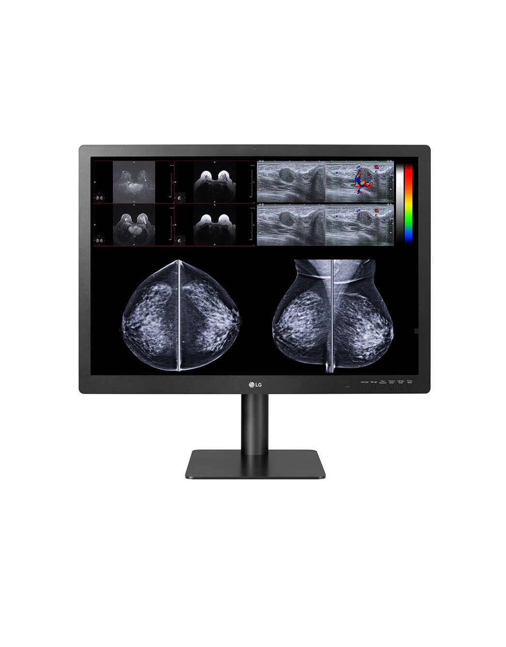 LG 31HN713D-B 31(78.74 cm) 12MP Diagnostic Monitor Specifications | LG IN