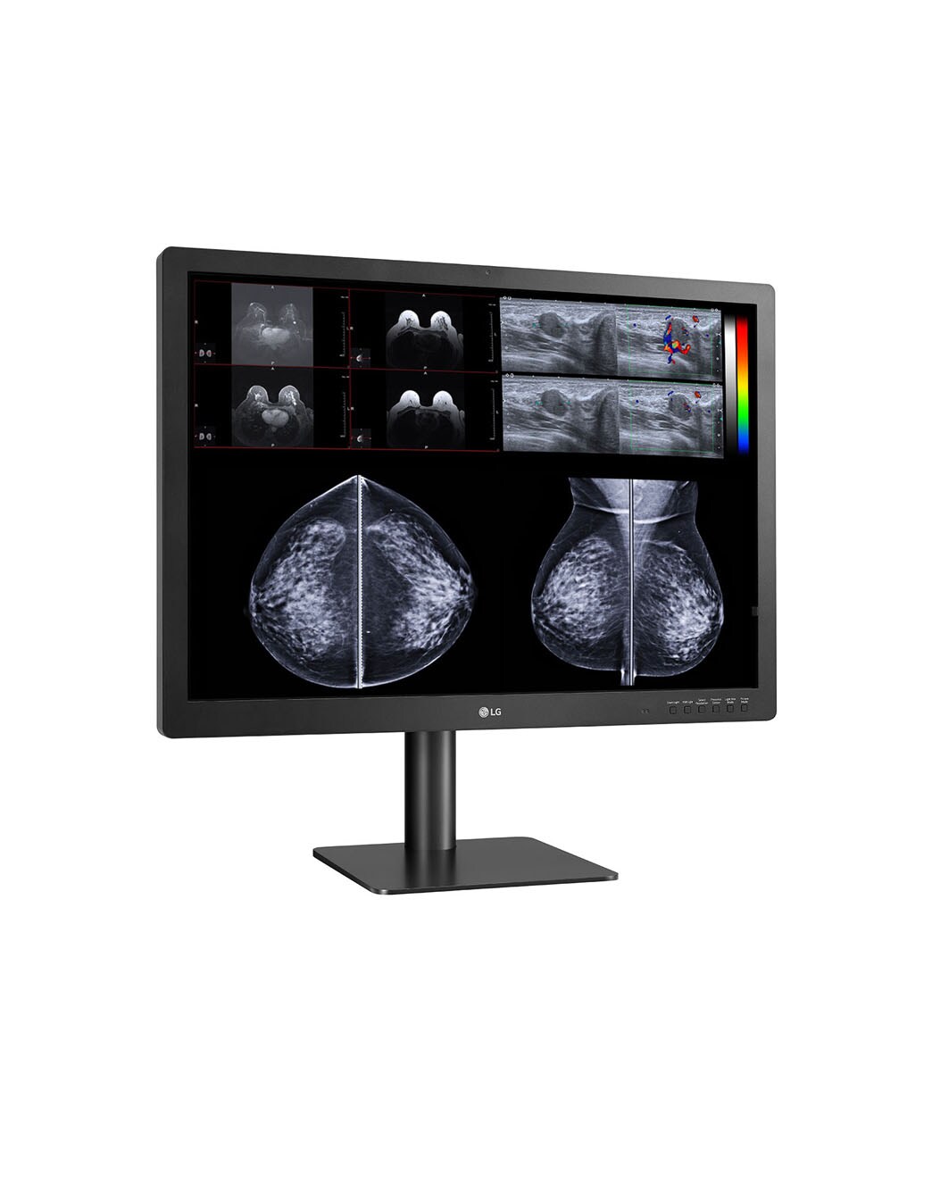 LG 31HN713D-B 31(78.74 cm) 12MP Diagnostic Monitor Specifications | LG IN