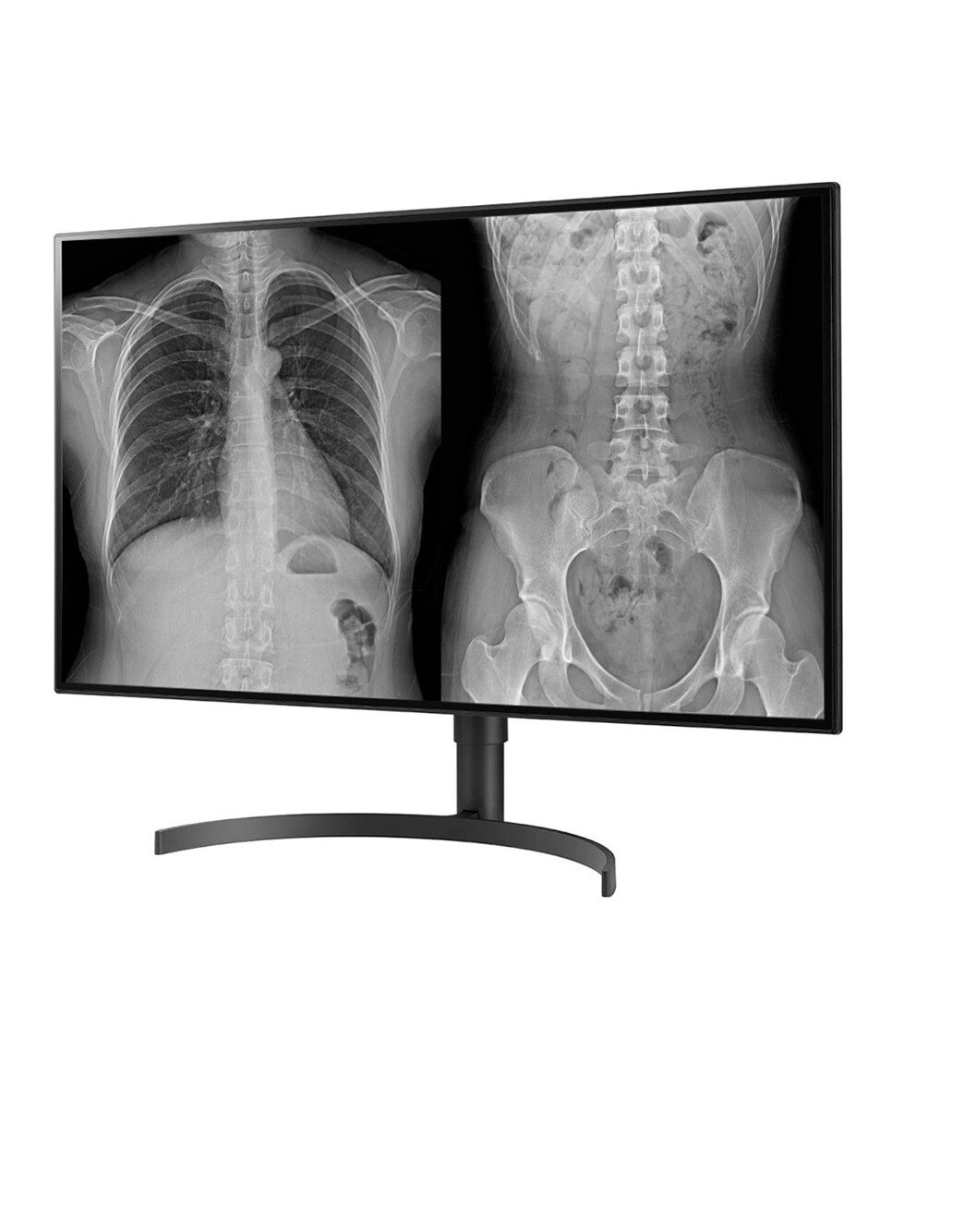 LG 31.5 (80.01cm) UHD 8MP Diagnostic Monitor | 32HL512D-B | LG India ...