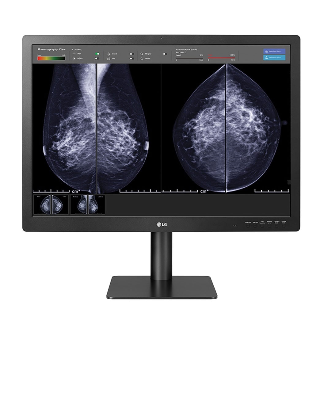 LG 31'' 12MP IPS Diagnostic Monitor for Mammography - 31HN713D | LG MX