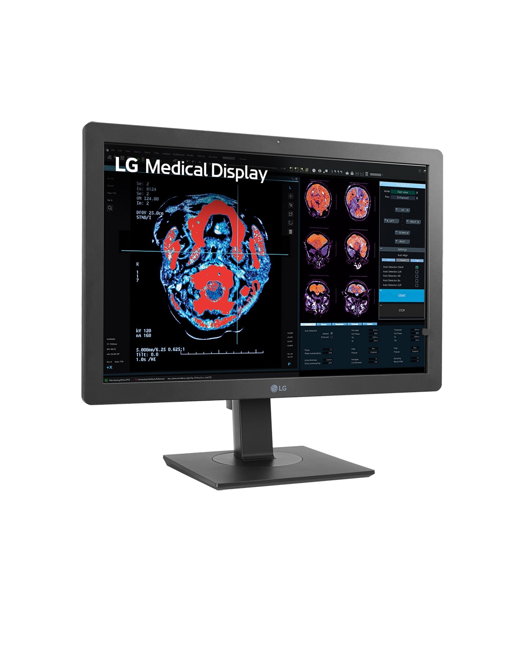 24" 2MP IPS diagnostische monitor - 24HR513C-B | LG Nederland