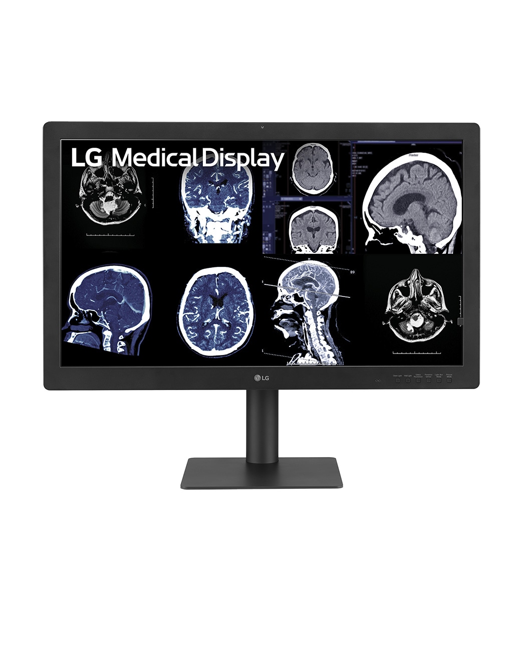 Monitor de diagnóstico negro IPS de 31,5 pulgadas y 8 MP | LG Panamá
