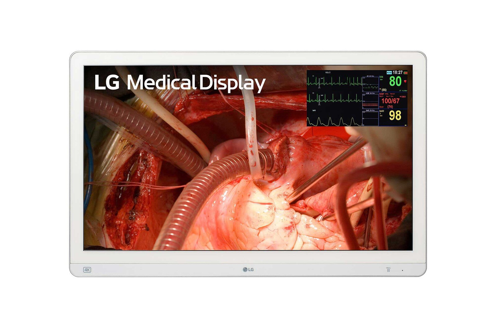 LG 2023 27inch 4K Surgical Monitor | LG SA | LG SA