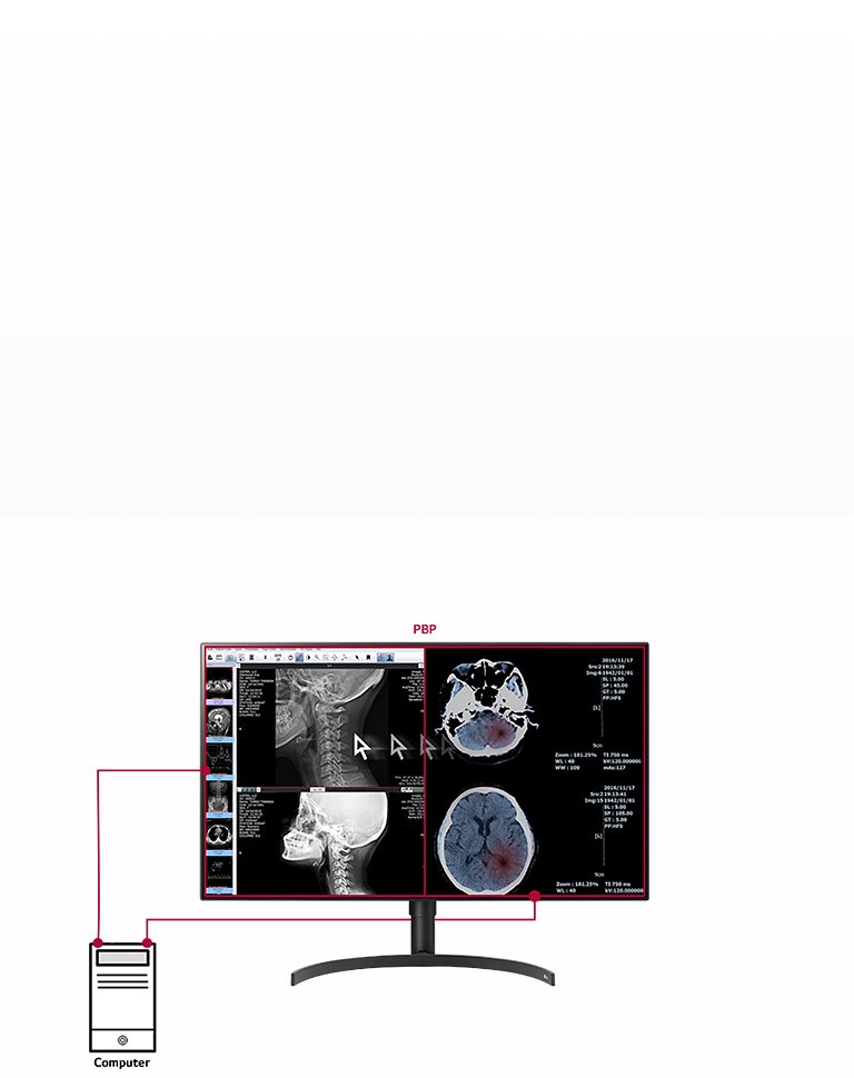 31.5'' 8MP (3840x2160) Nano IPS Color Diagnostic Monitor with Multi ...