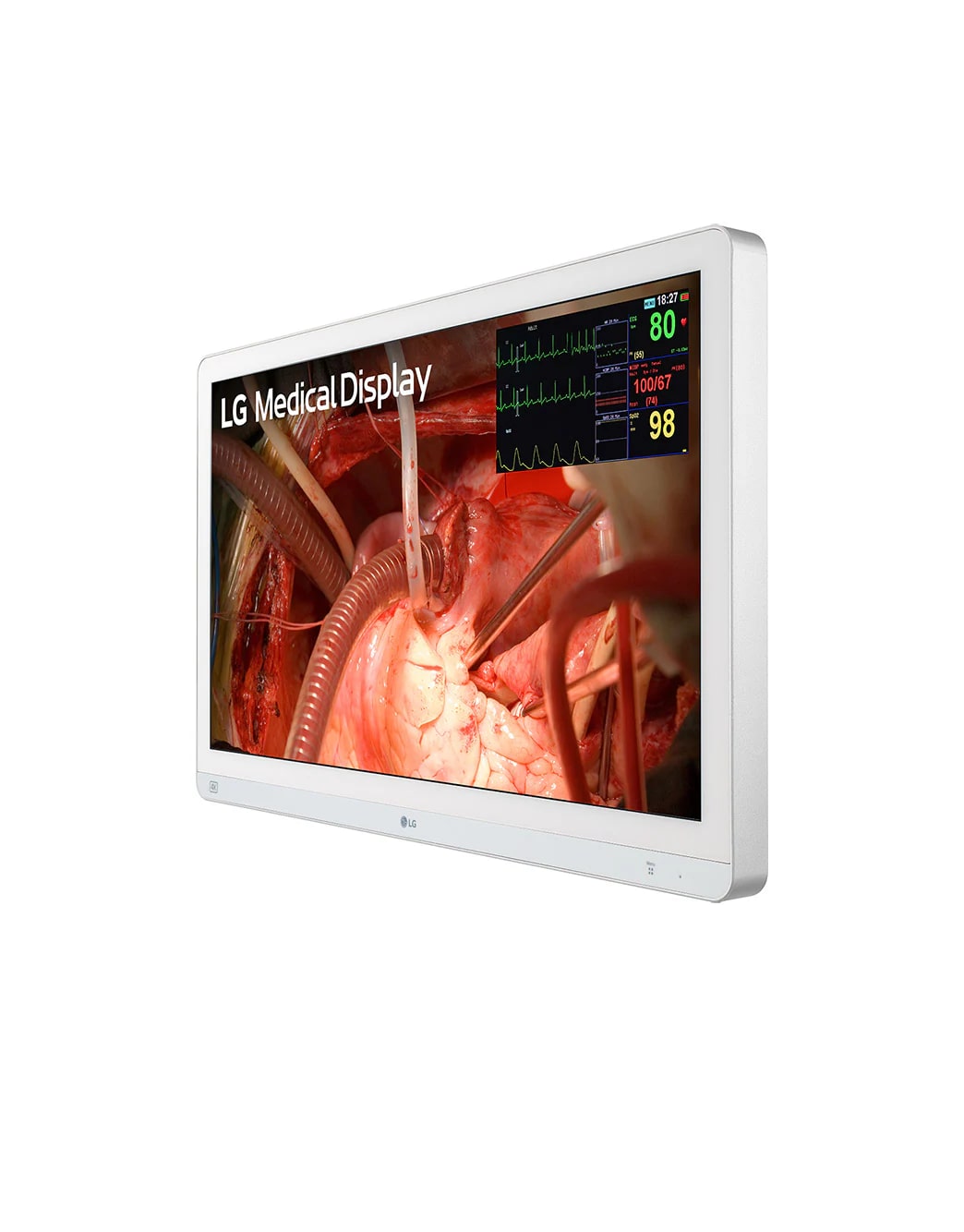 27-inch 4K Surgical Monitor with Mini-LED - 27HQ710S-W | LG TH
