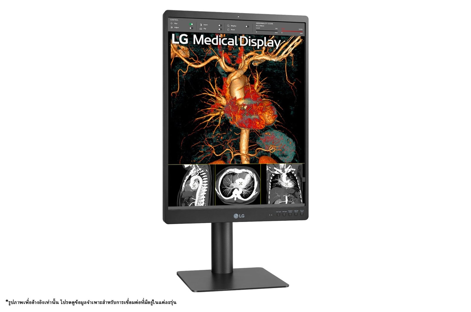 21HQ513D-S | Diagnostic Monitor | MEDICAL MONITORS | LG TH