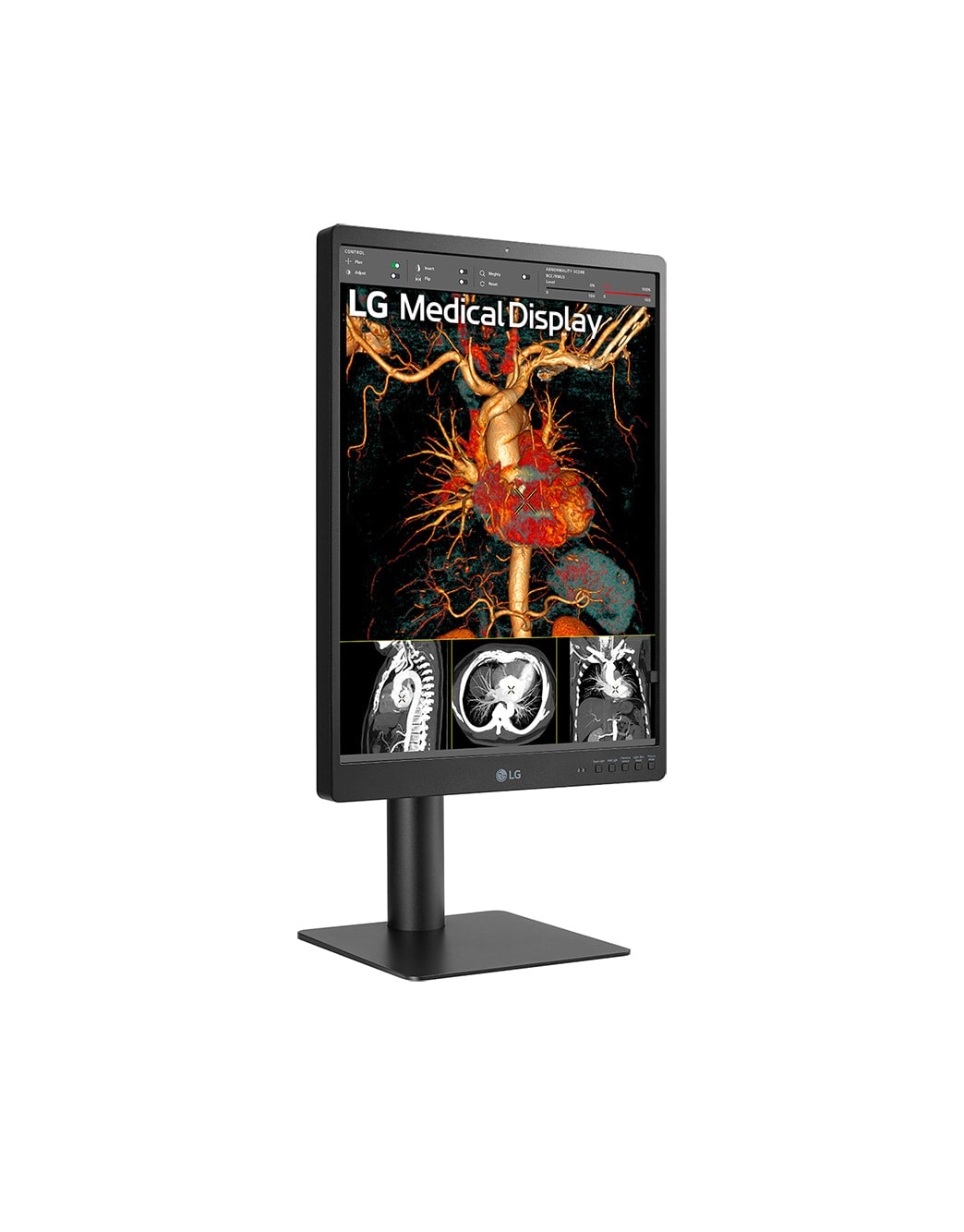 LG 21.3'' 3MP IPS Diagnostic Monitor - 21HQ513D-B | LG UK