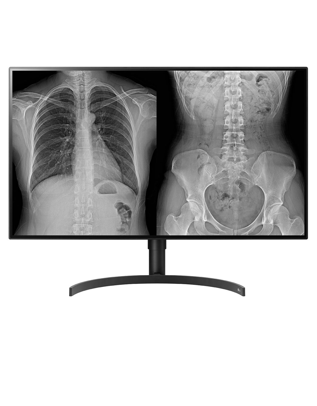 31.5'' LG 8MP Diagnostic Monitor | LG UK | LG UK